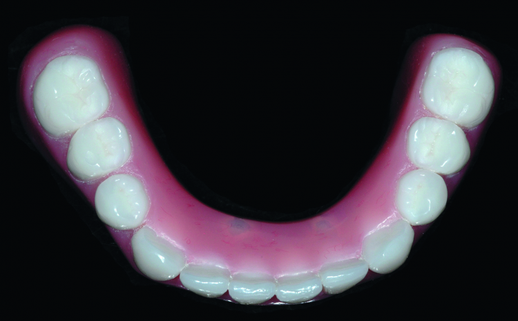 Dental News - Treatment options for the edentulous arch