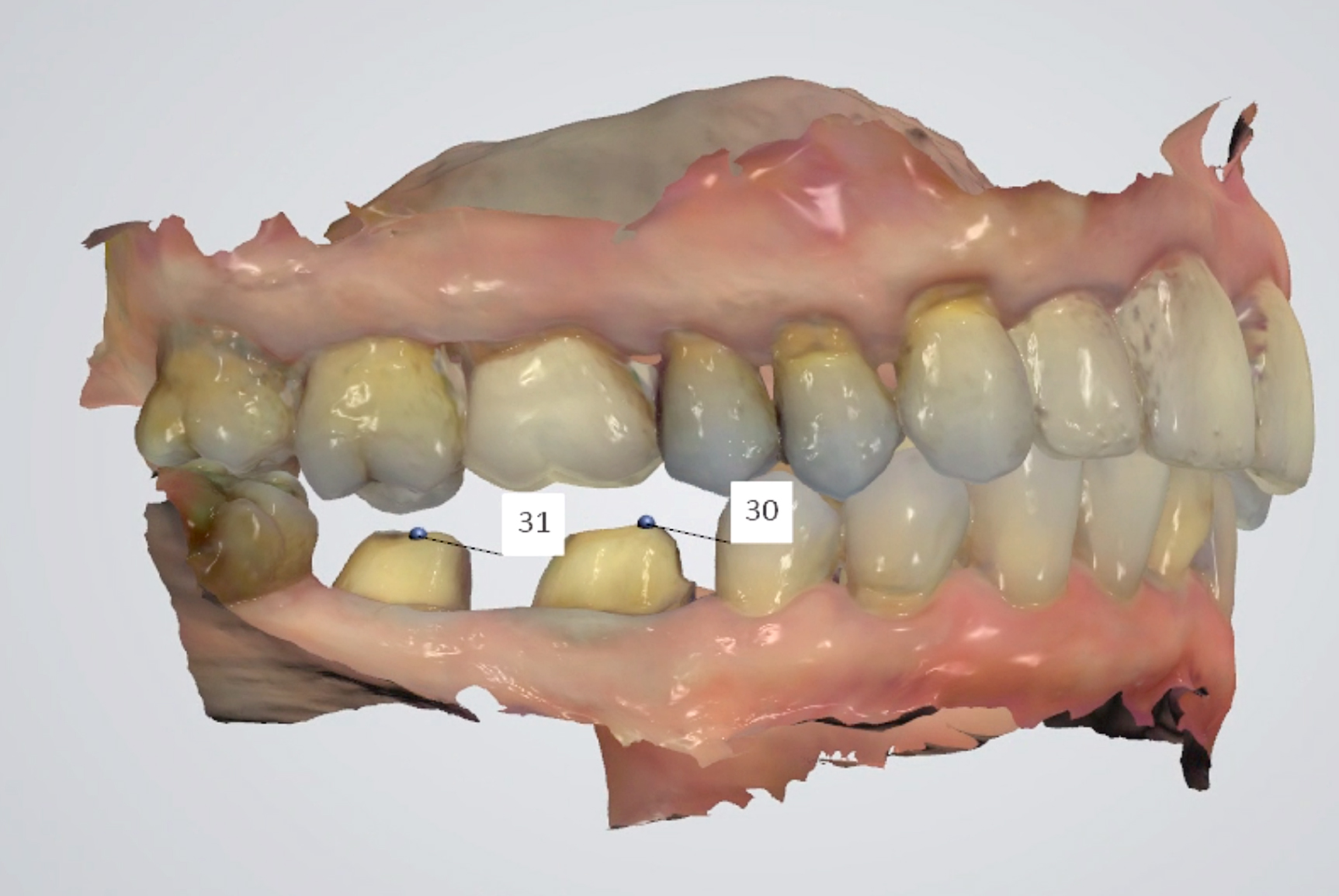 Dental News - Occlusion principles for the practising dentist in the ...