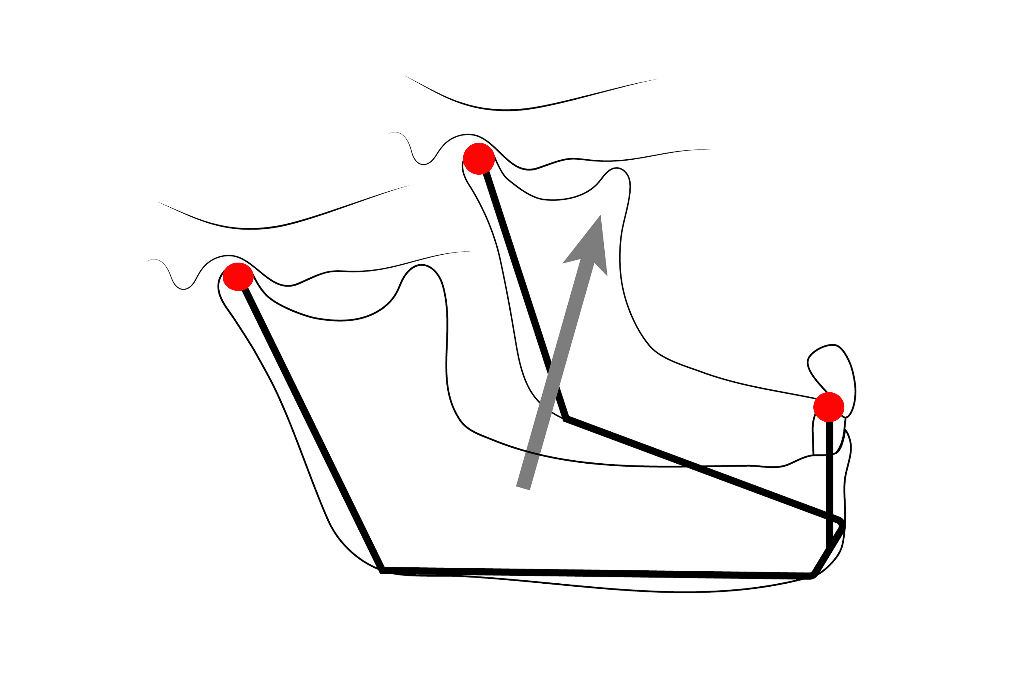 Dental News - Occlusion principles for the practising dentist in the ...