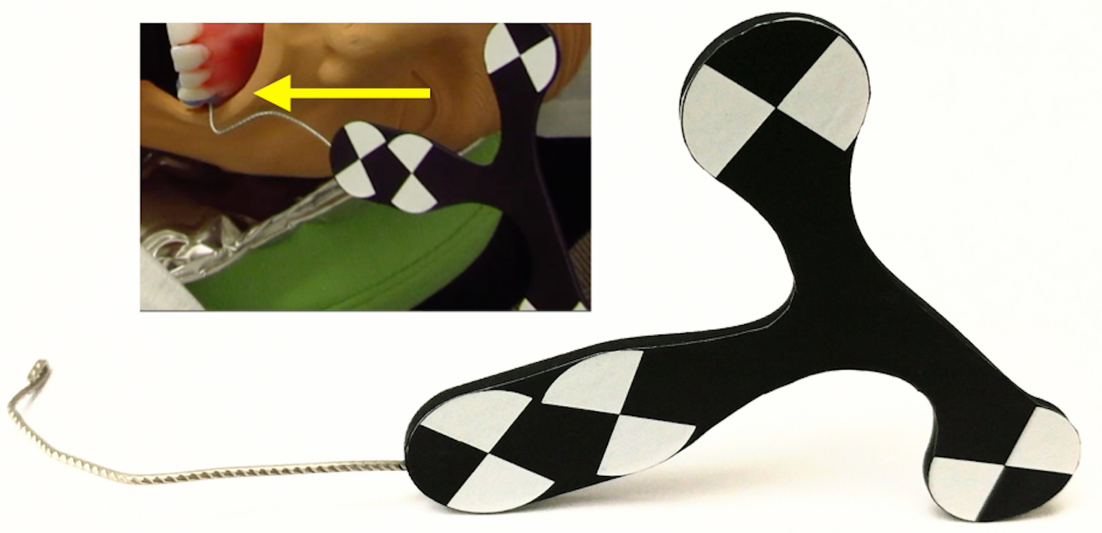 Dental News - Dynamic navigation—The future of minimally invasive ...