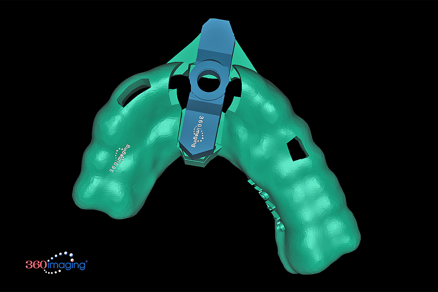 Dental News - Guided applications for partial extraction therapy