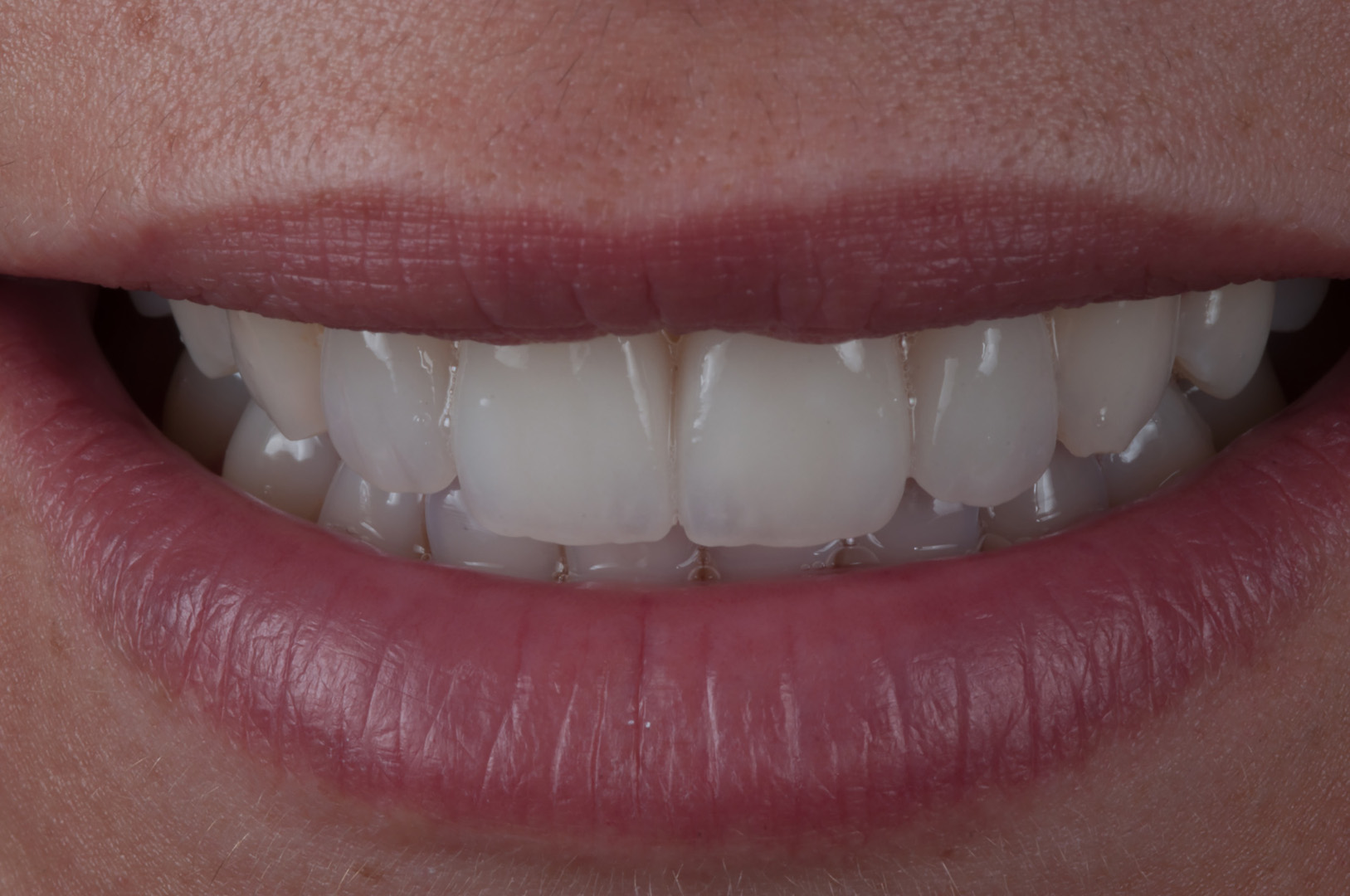 Surface texture: Using horizontal and vertical lines to simulate ...