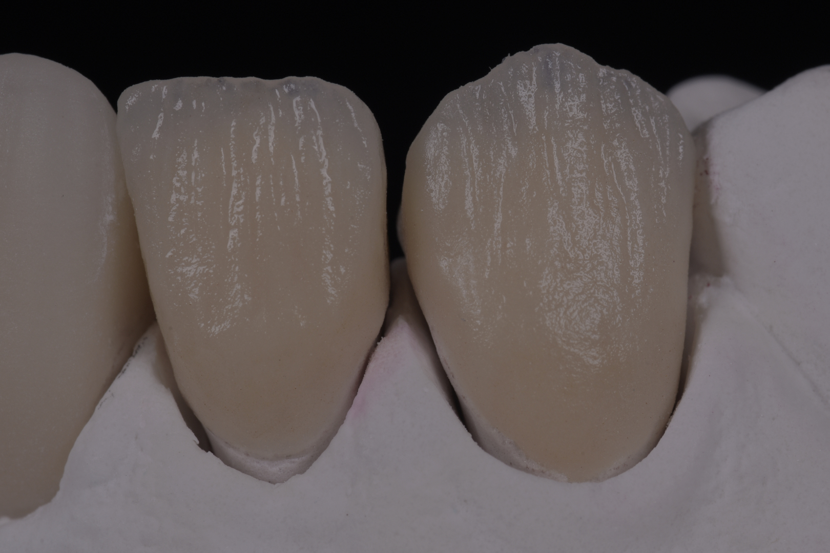 Surface texture: Using horizontal and vertical lines to simulate ...